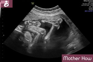 28 Weeks Pregnant Fetal Development, Ultrasound, Belly Pictures - MotherHow