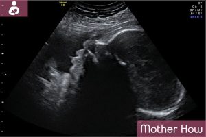 35 Weeks Pregnant: Mind Your Meals and Posture - MotherHow