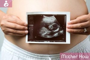Fetus Development Malformations: Risk Factors & Types - MotherHow